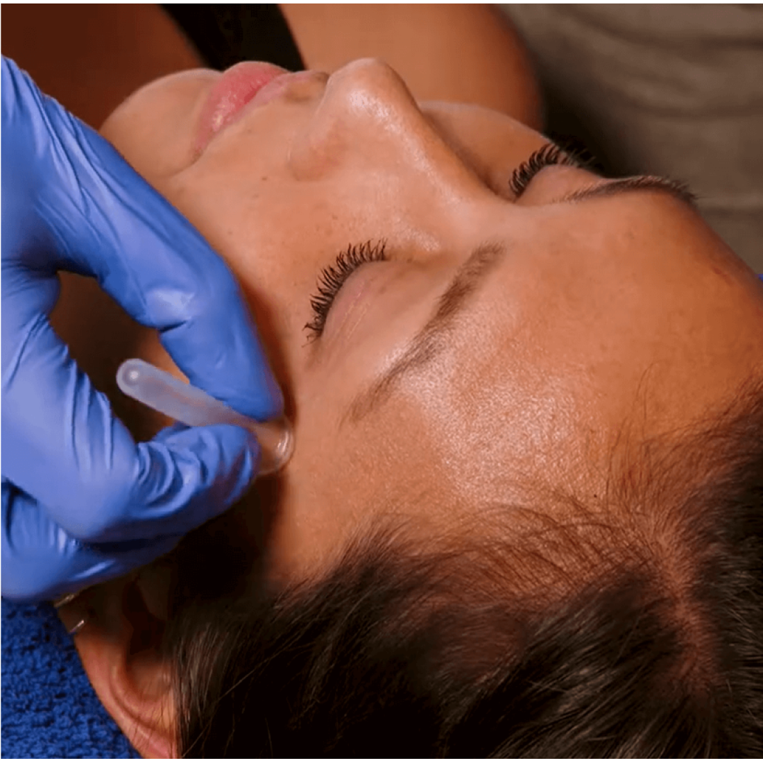 Fasciq Fascial Cupping Set